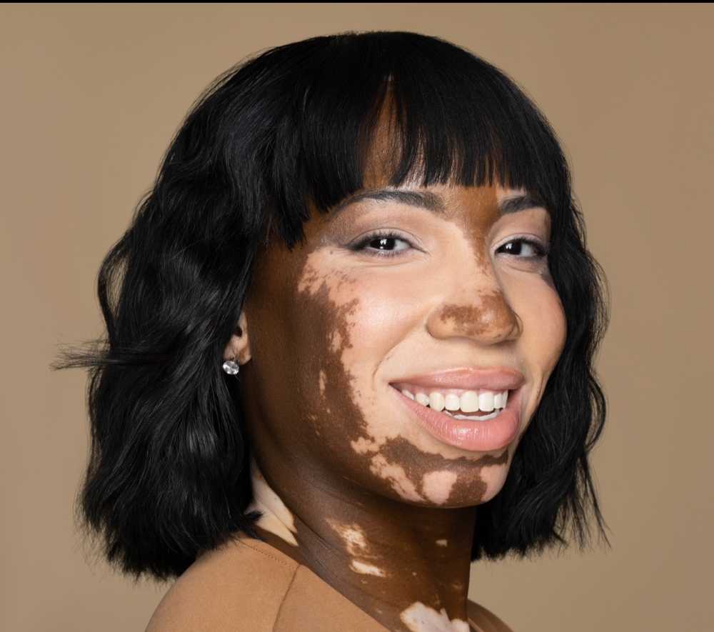 How This Fashion Model Is Defying Industry Norms & Championing Self ...